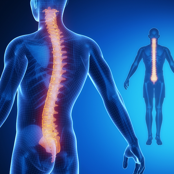 Minimally Invasive Spine Surgery NJ | Champey Pain & Spine